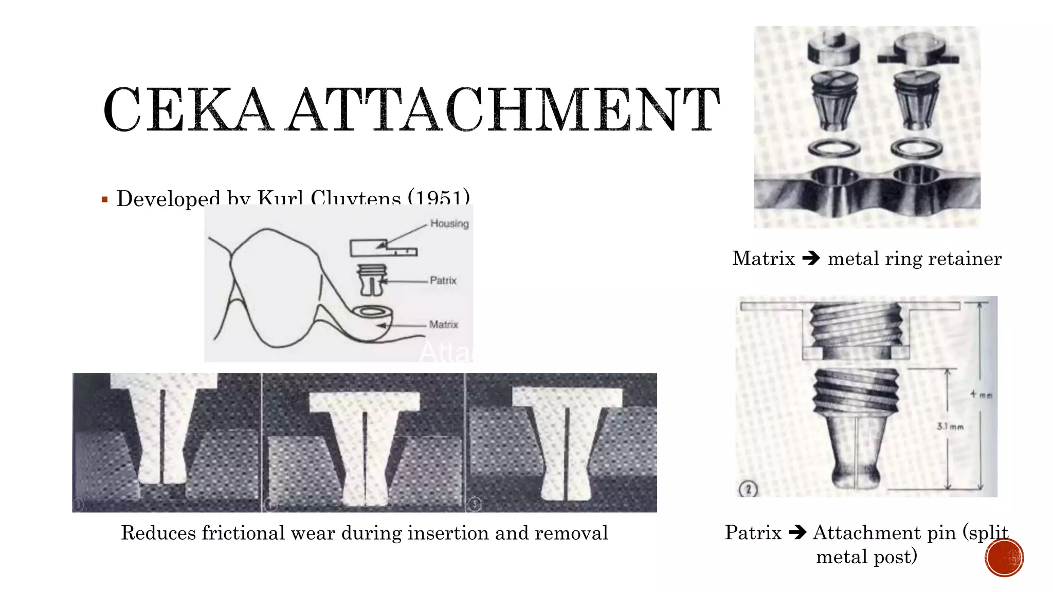 Precision attachment.pptx