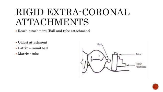 Precision attachment.pptx | Dental Health | Diseases and Conditions