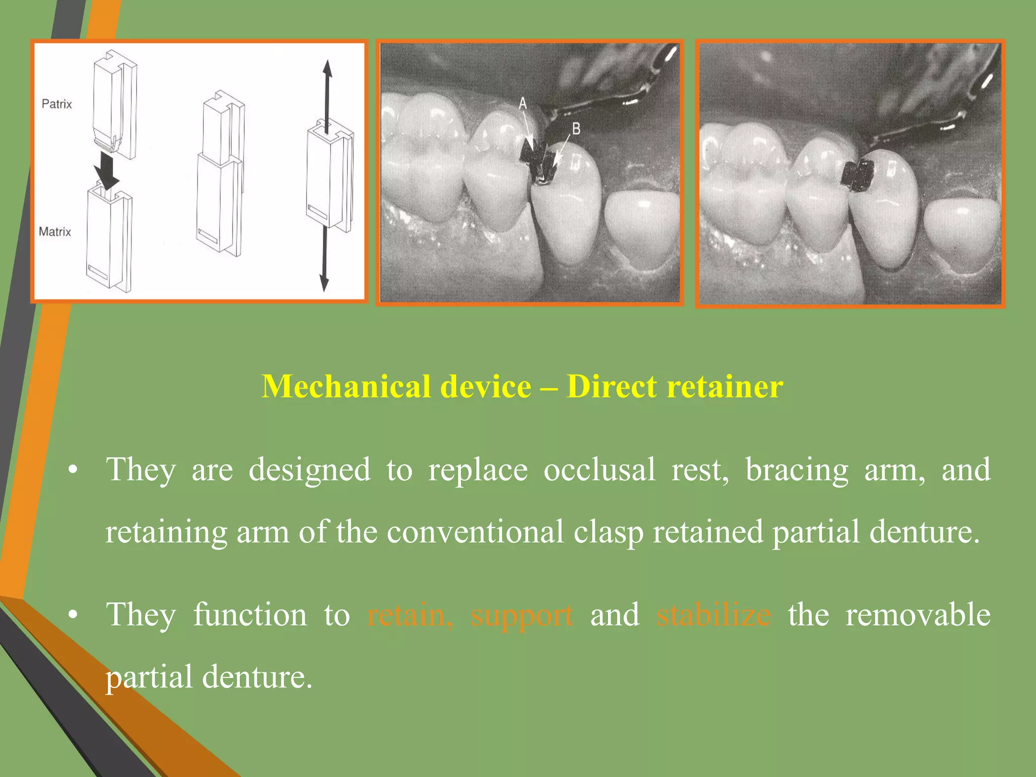 Precision attachments | PDF