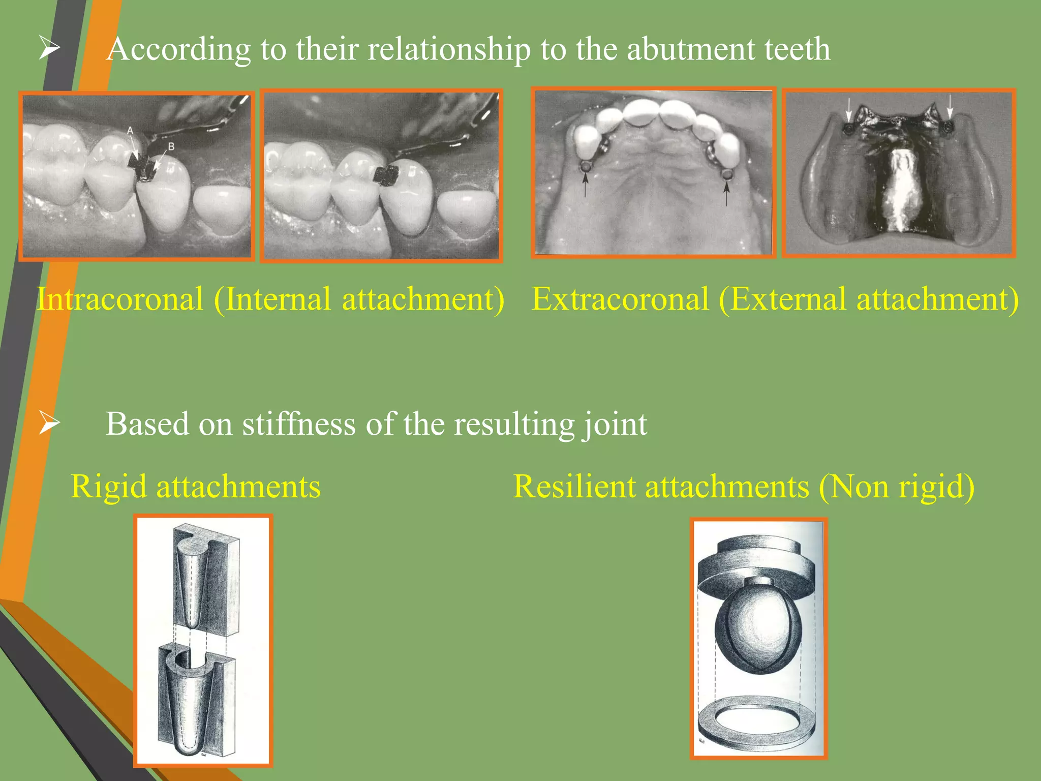 Precision attachments | PDF