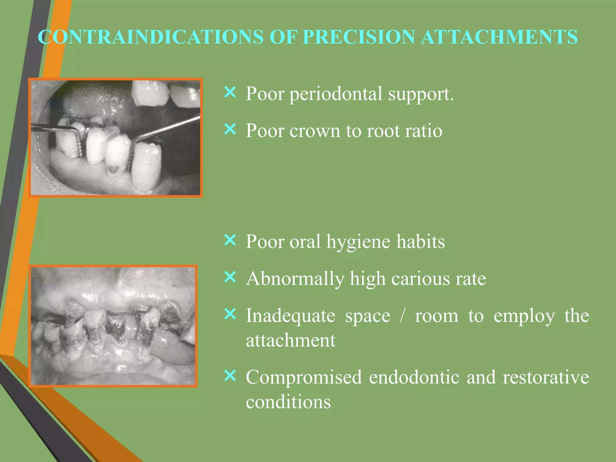 Precision attachments | PDF