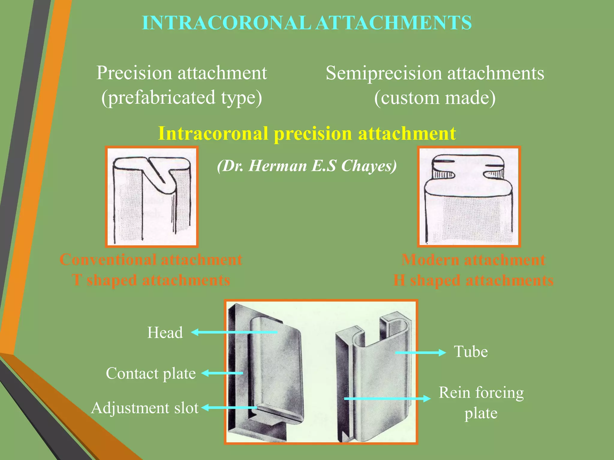 Precision attachments | PDF