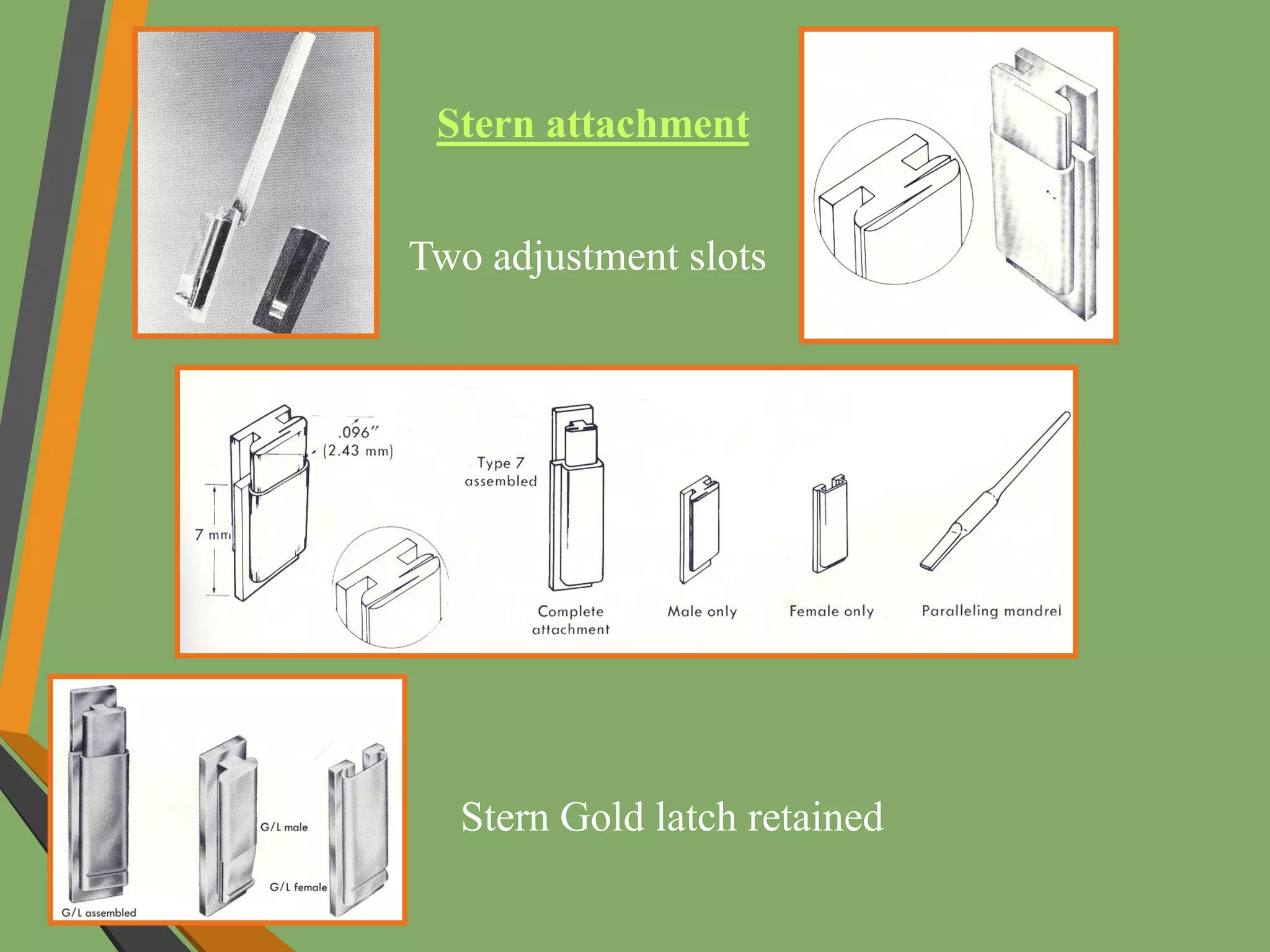 Precision attachments | PDF
