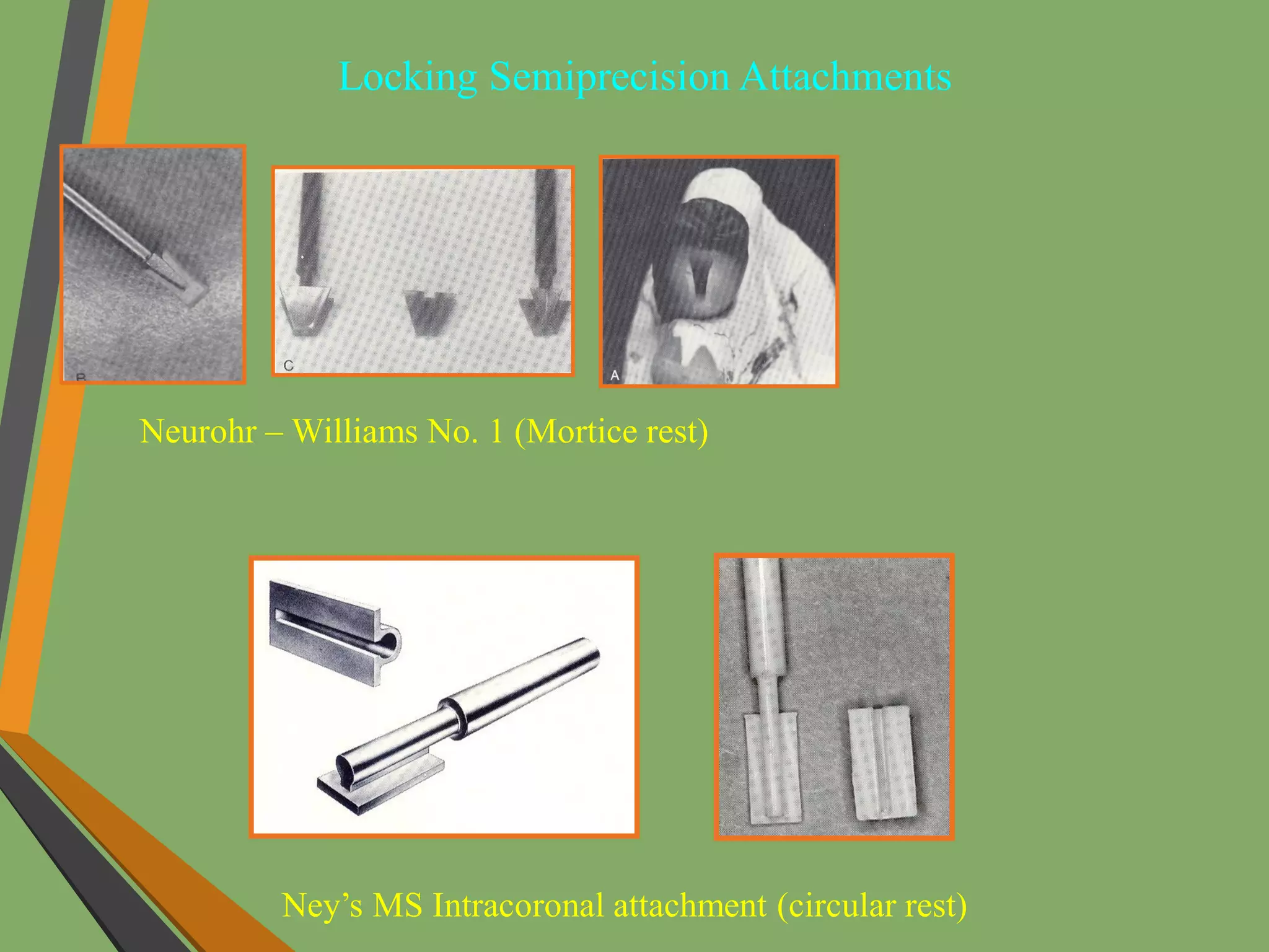 Precision attachments | PDF