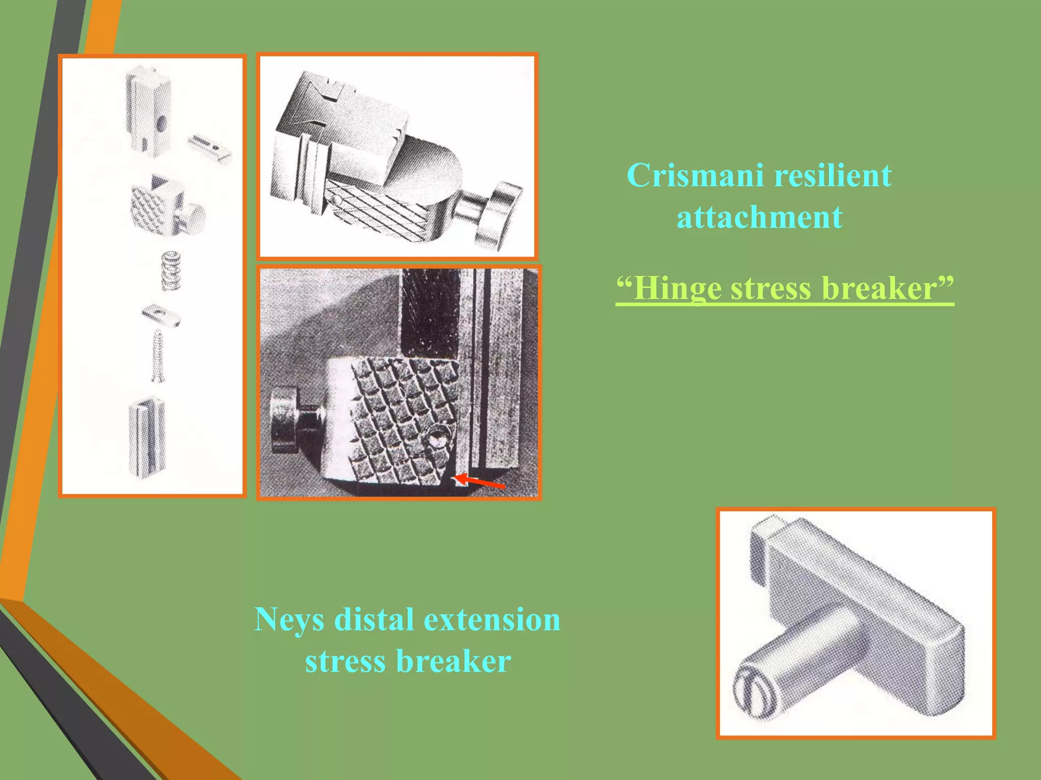 Precision attachments | PDF