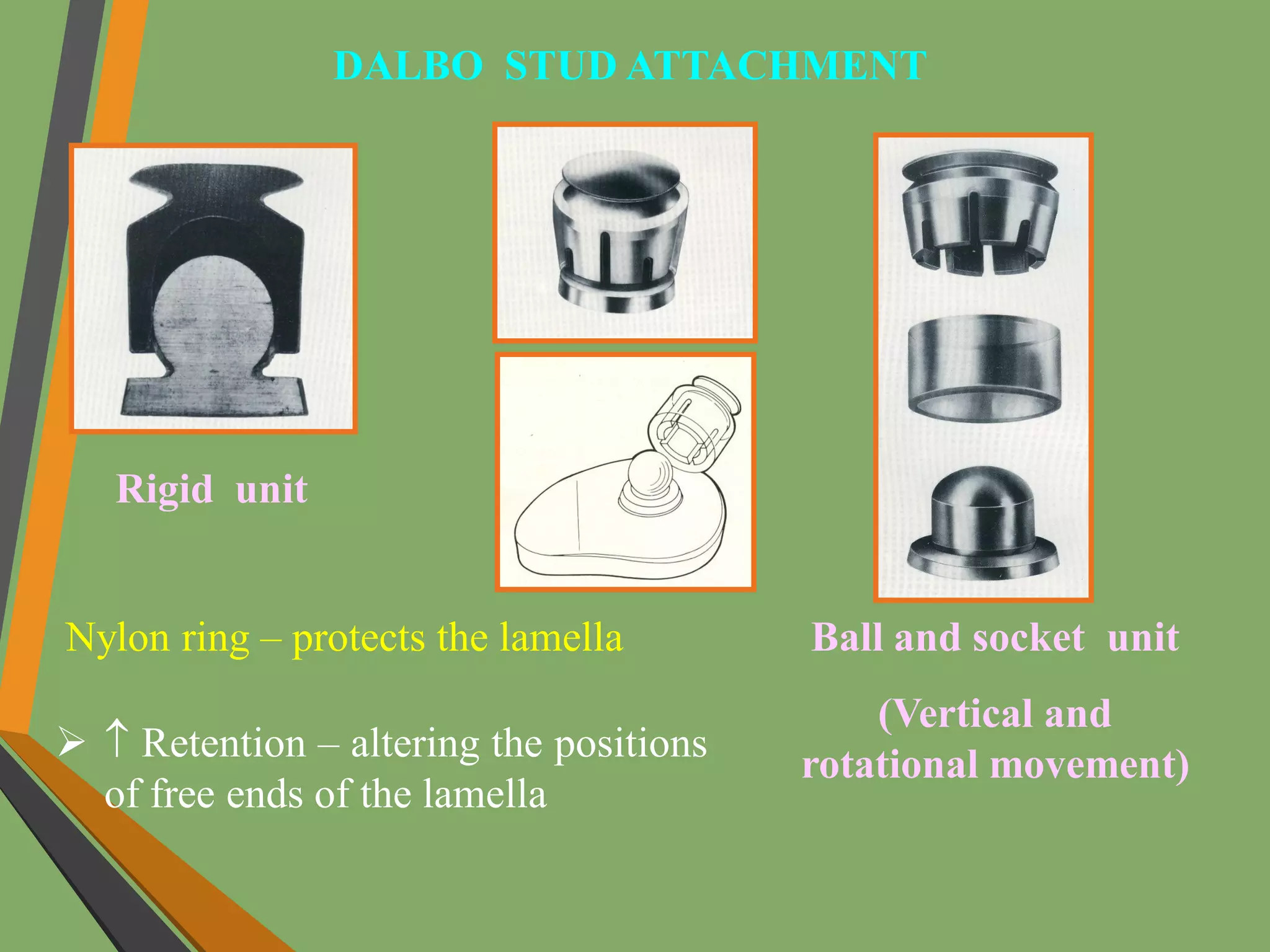 Precision attachments | PDF