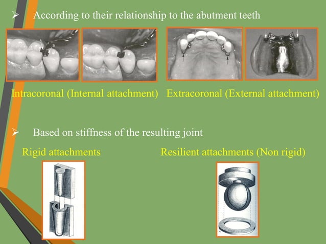 Precision attachments | PDF