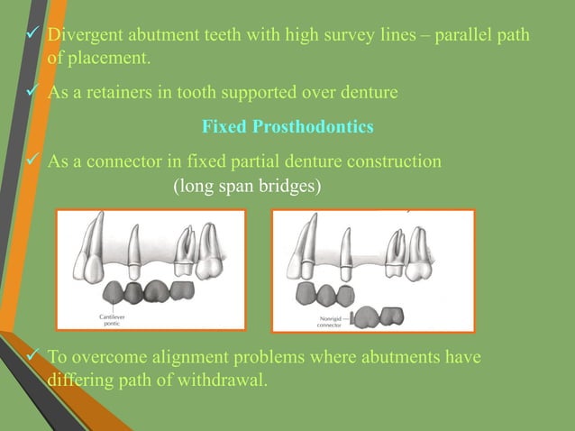 Precision attachments | PDF