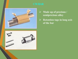 Precision attachments | PPT
