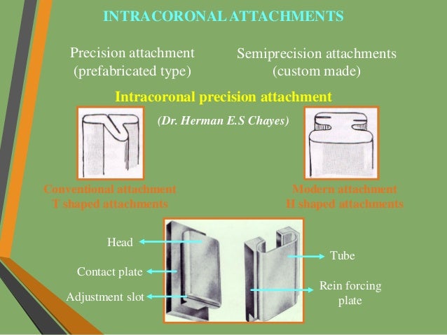 Precision attachments