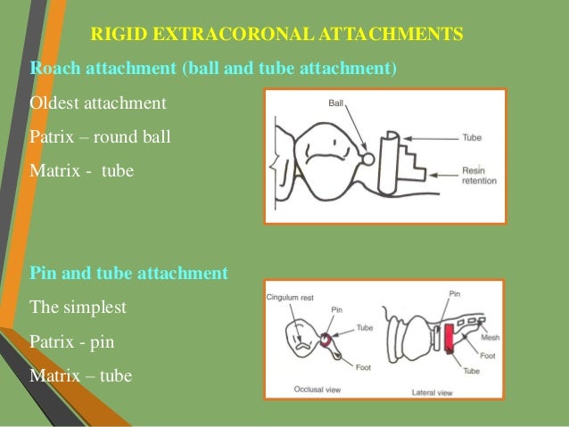 Precision attachments