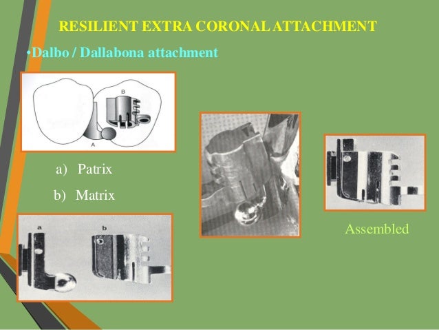 Precision attachments