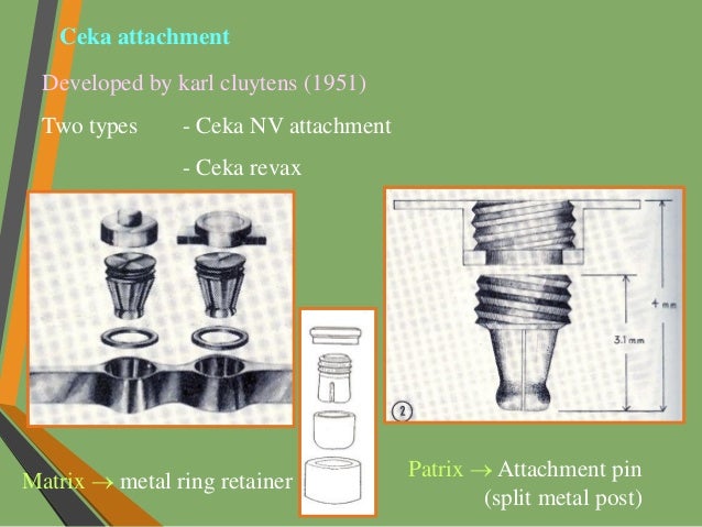 Precision attachments