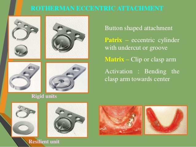 Precision attachments
