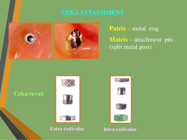 Precision attachments