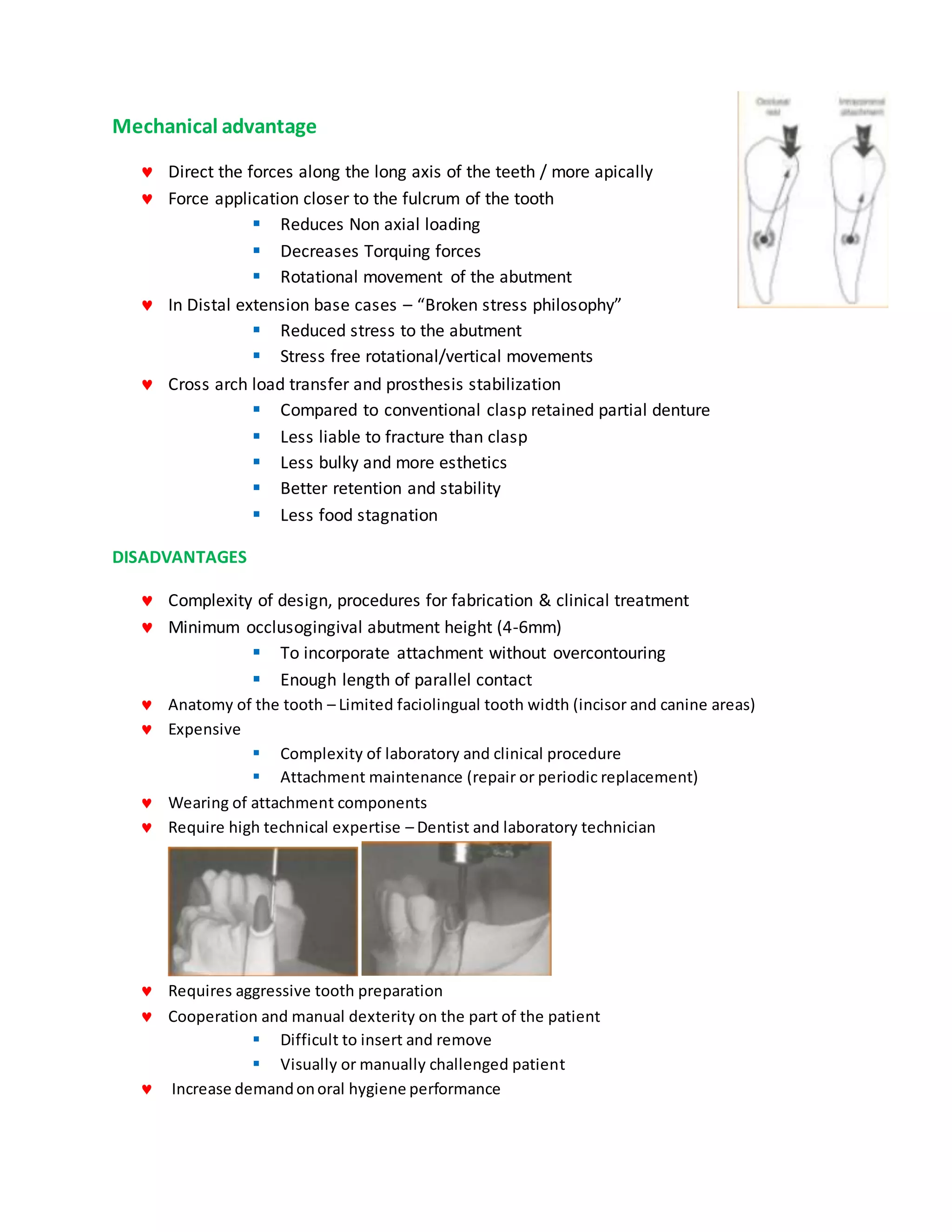 Precision attachments | DOCX