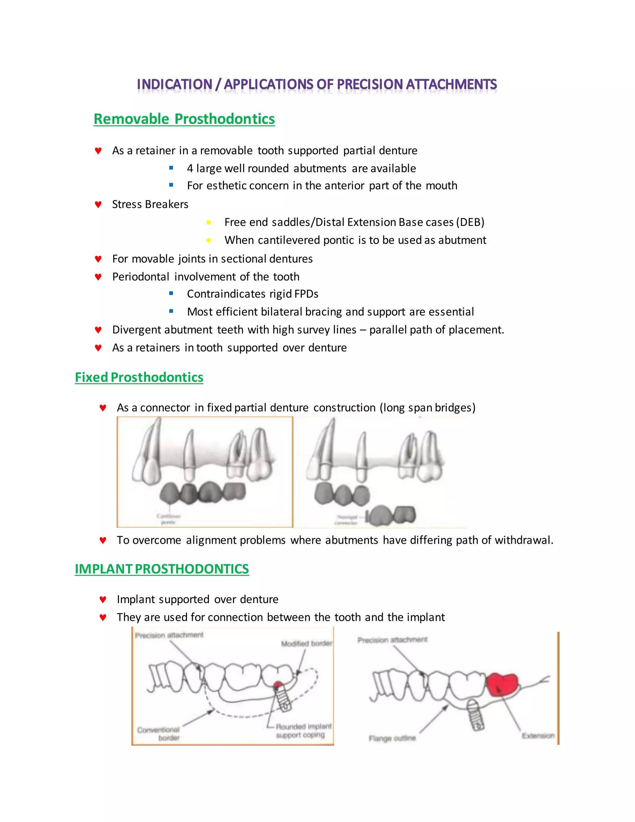 Precision attachments | DOCX