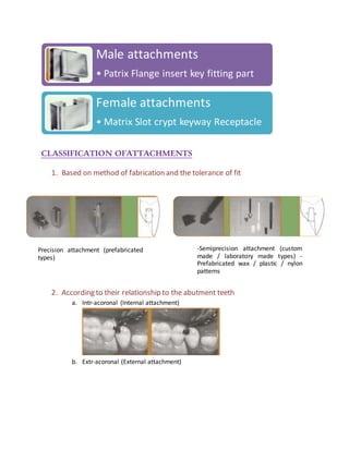 Precision attachments | DOCX