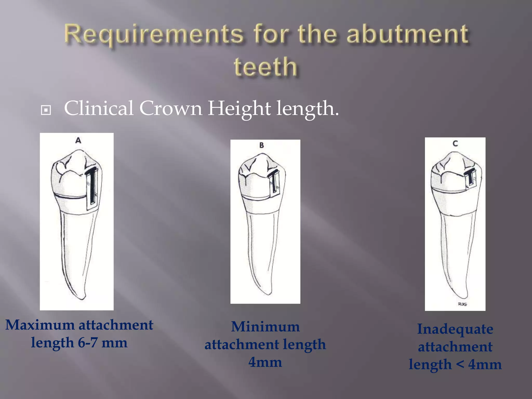 Precision attachments | PPTX