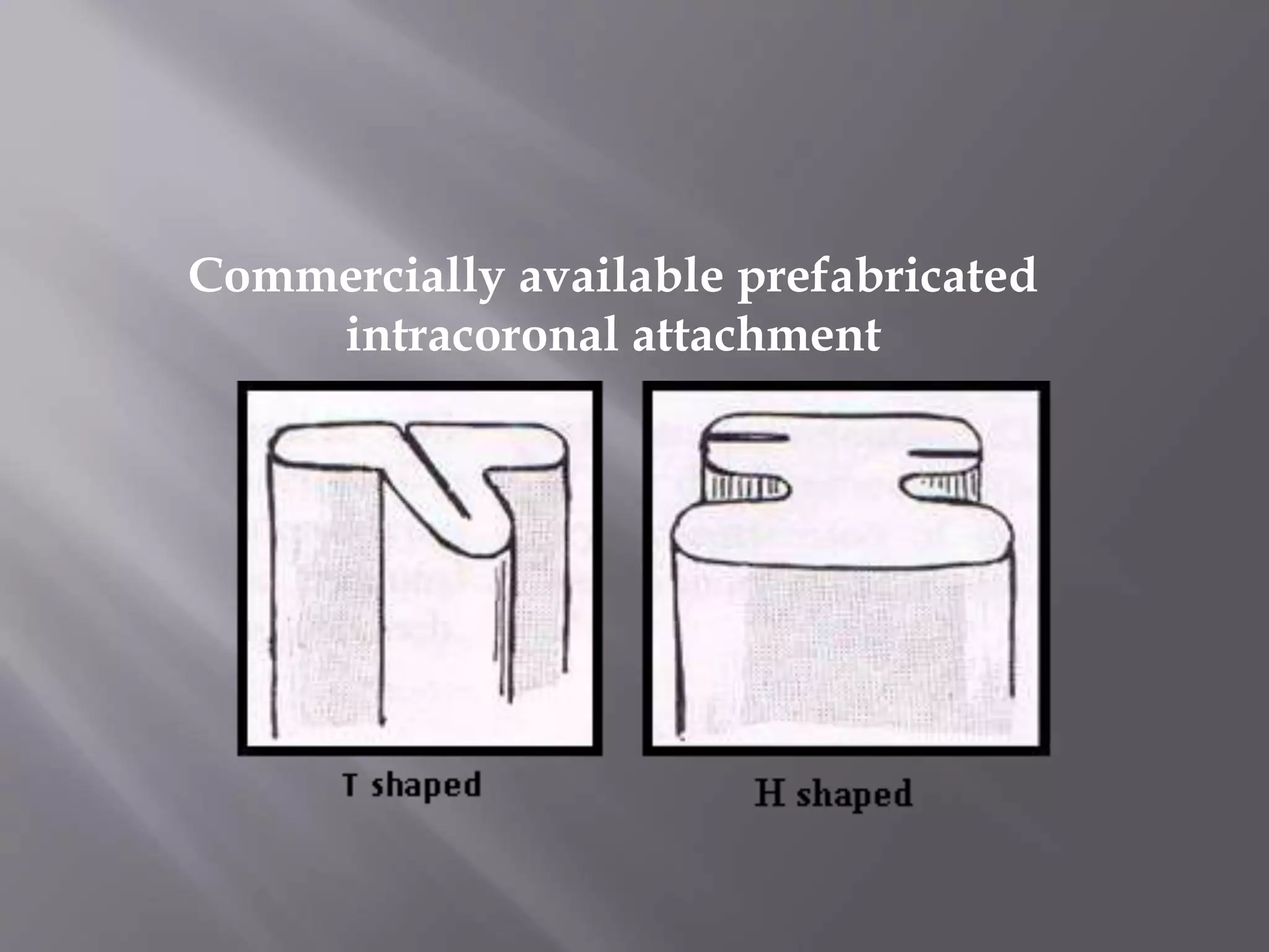 Precision attachments | PPTX