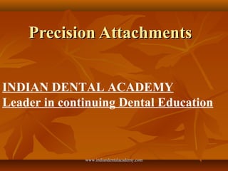 Precision attachments1/endodontic courses | PPT