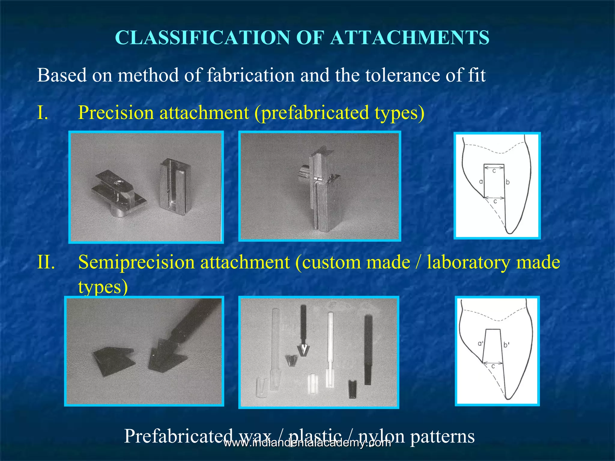 Precision attachments in prosthodontics/ orthodontic seminars | PPT