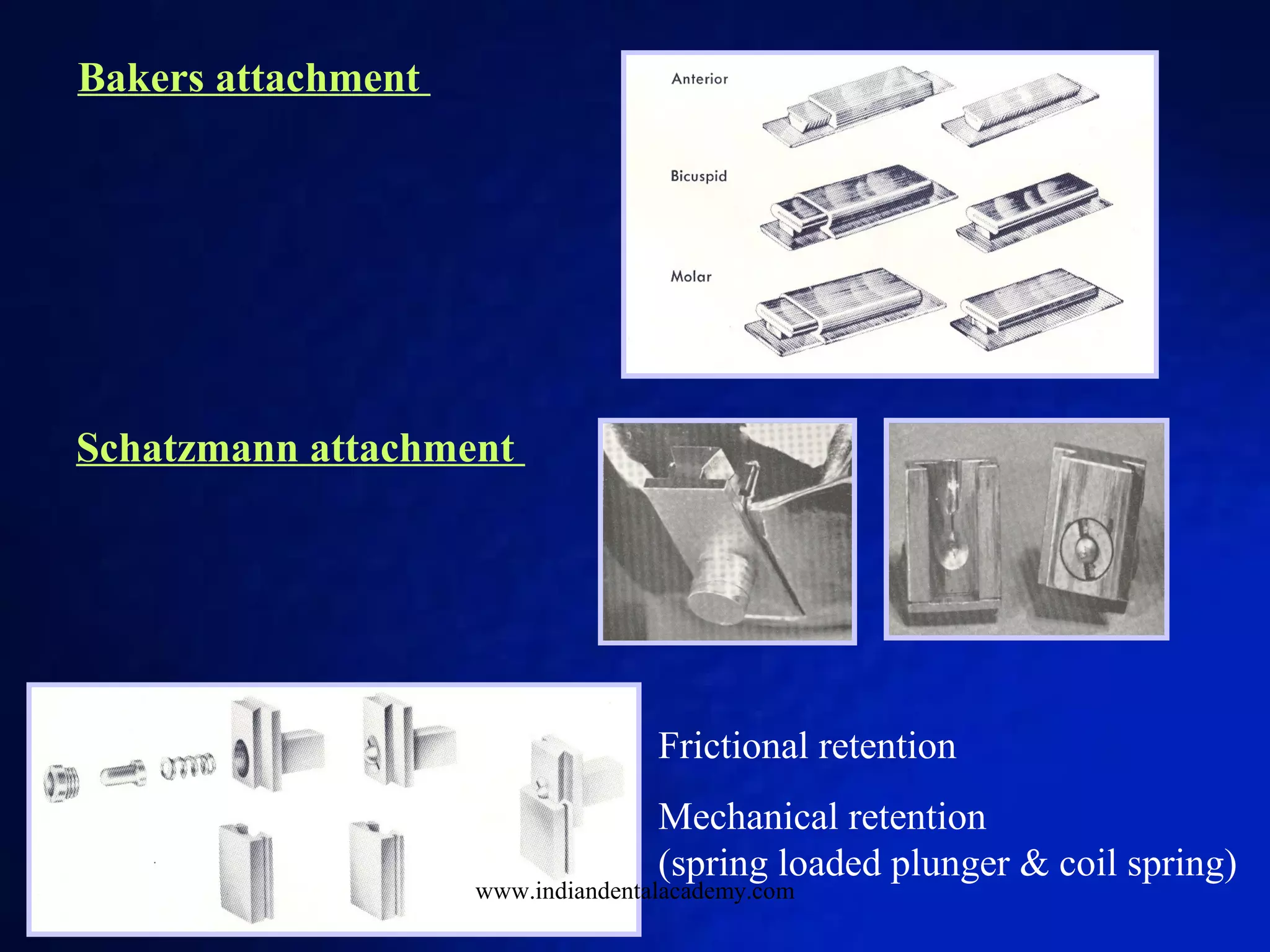 Precision attachments final/ dental implant courses | PPT | Dental ...