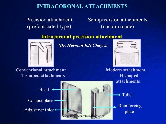 Precision attachments final/ dental implant courses