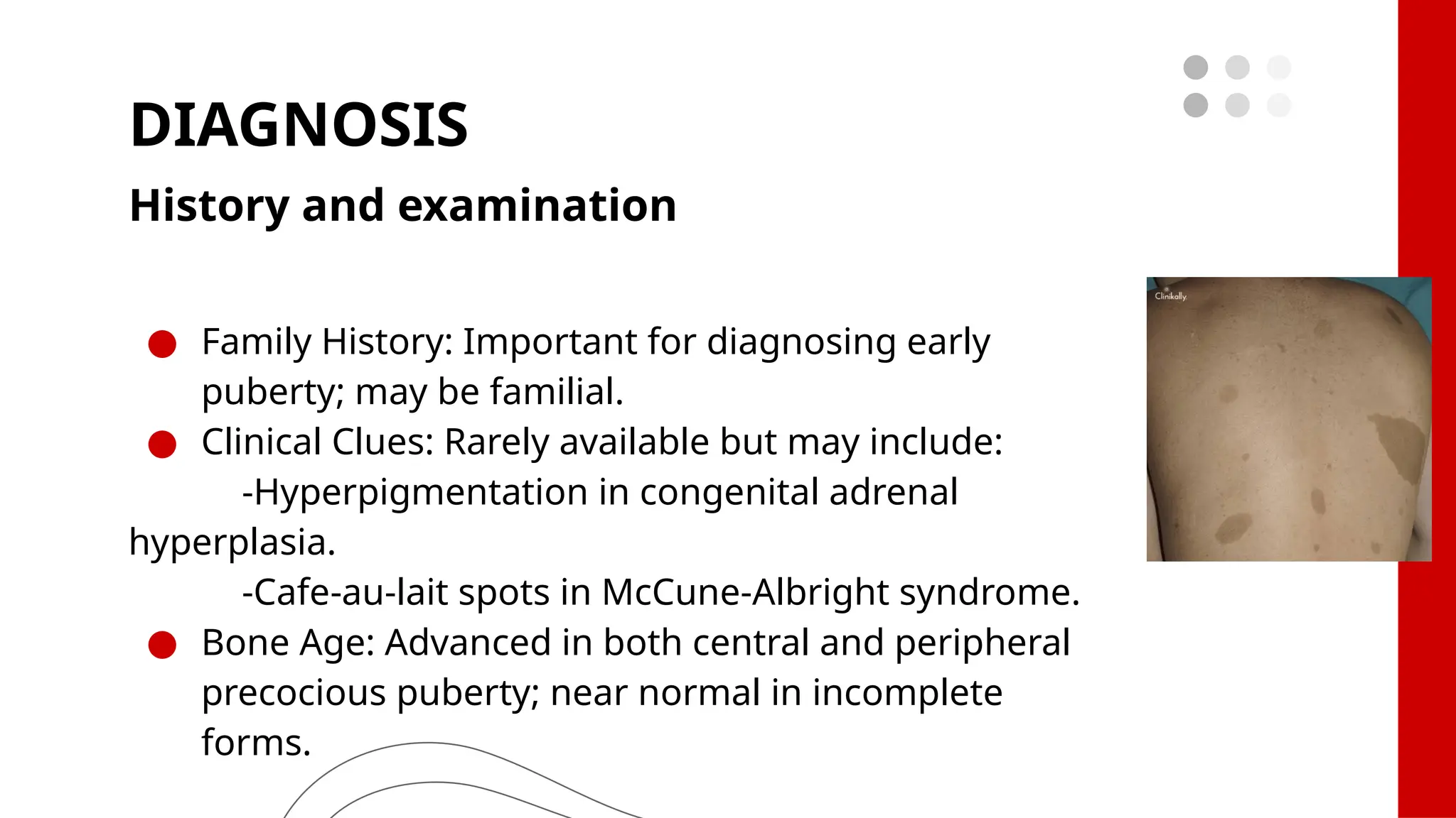 Precocious puberty OBG 3rd year.pptx.pptx