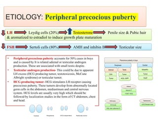 Precocious Puberty in boy ; update in diagnosia and treatment | PPTX