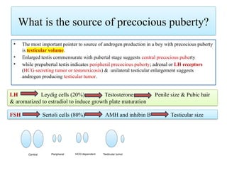 Precocious Puberty in boy ; update in diagnosia and treatment | PPTX