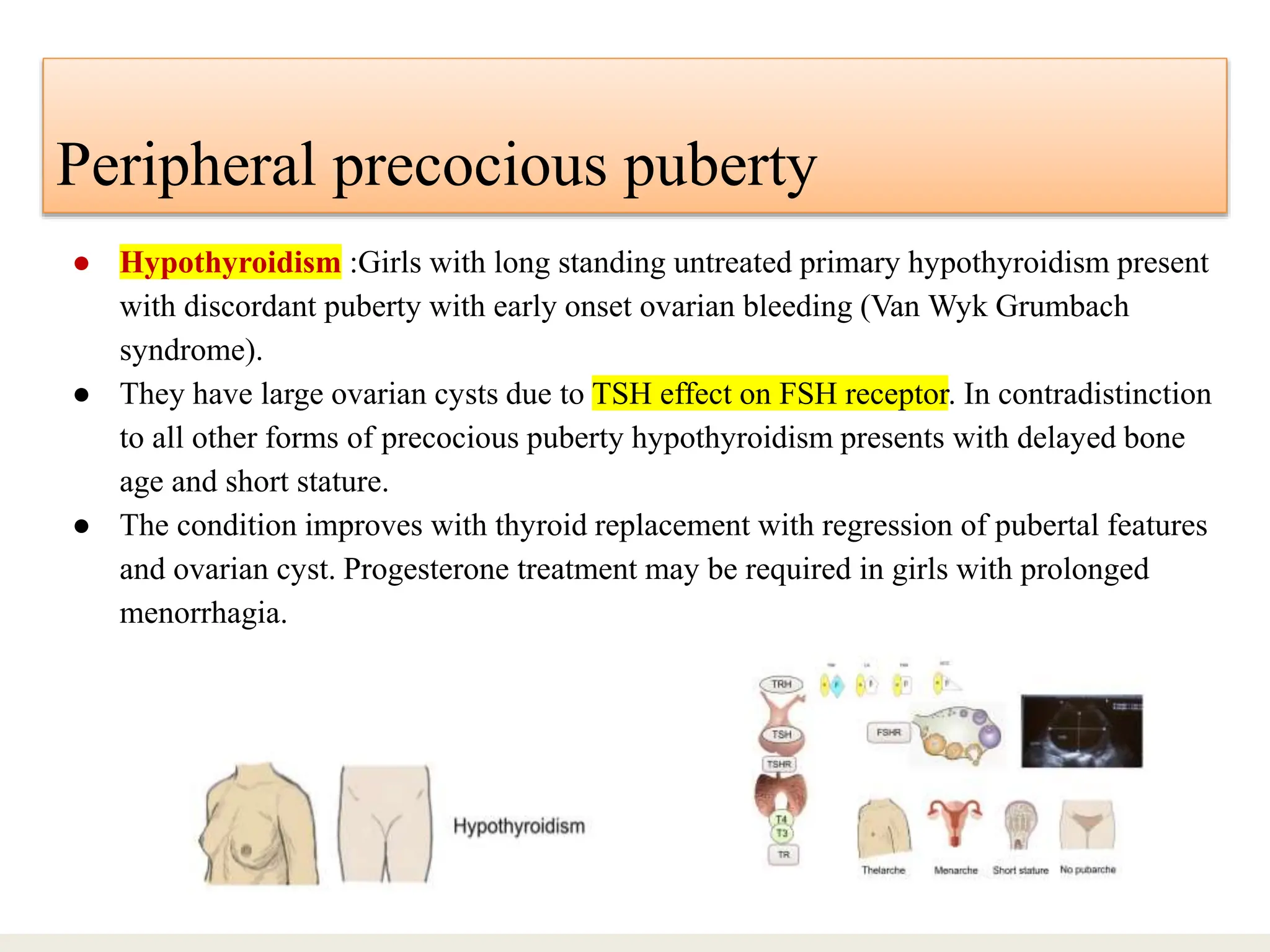 Precocious Puberty in Girl approach and Management | PPTX