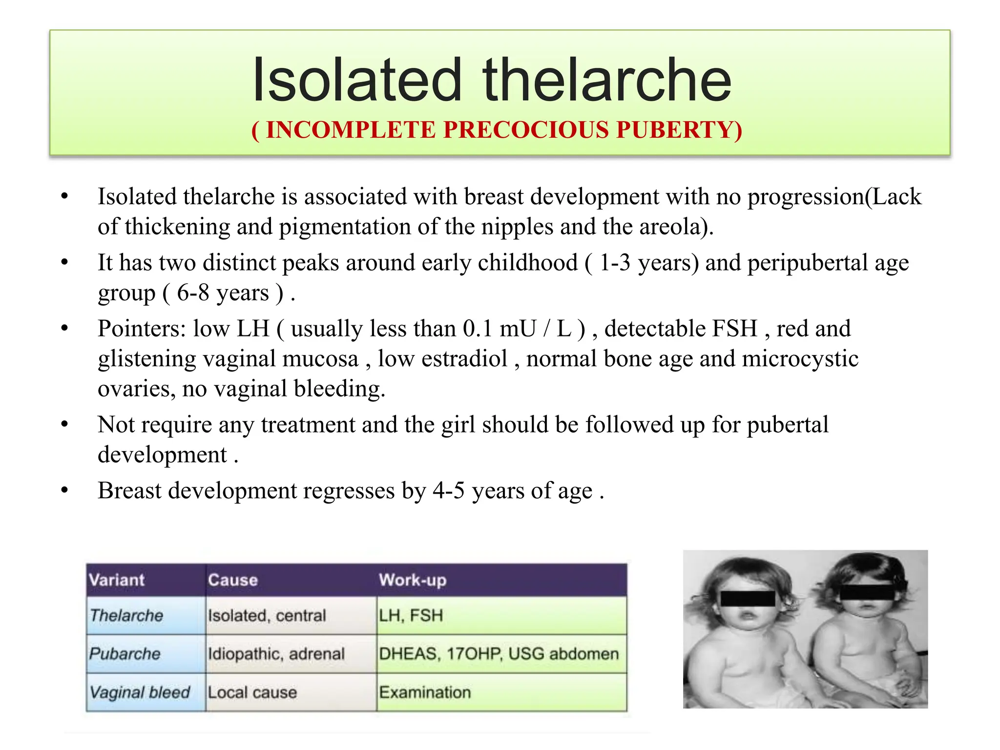 Precocious Puberty in Girl approach and Management | PPTX