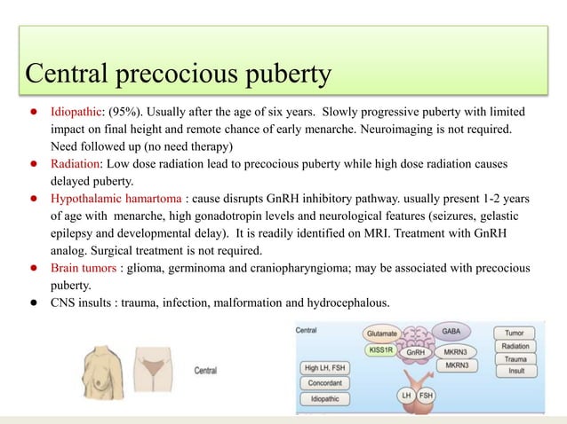 Precocious Puberty in Girl approach and Management | PPTX