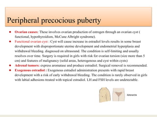 Precocious Puberty in Girl approach and Management | PPTX