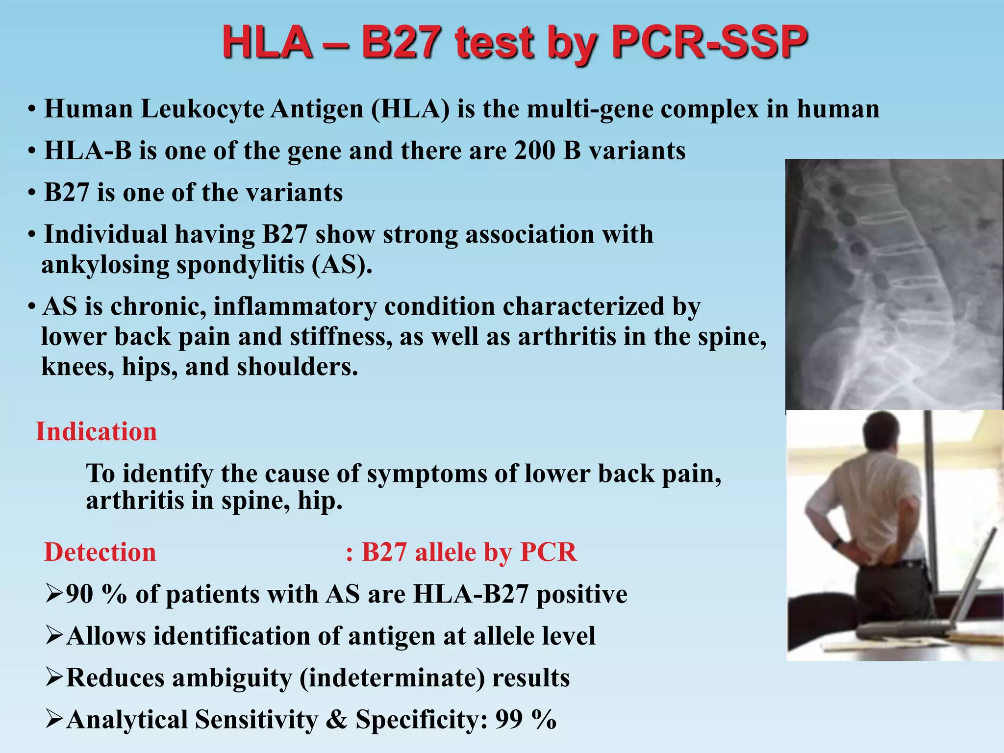 PrecriptionPiont - 2.ppt | Infectious Diseases | Diseases and Conditions
