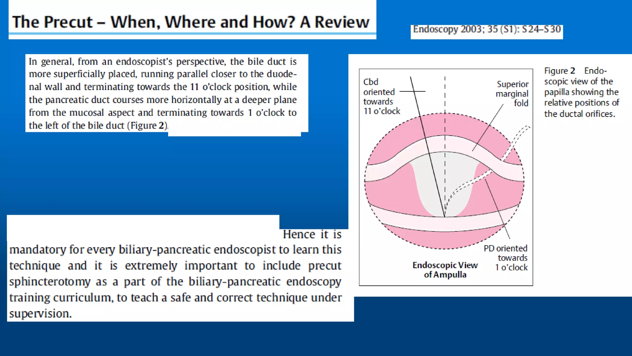 Precut ERCP, Fistulotomy, Papillotomy, Transpancreatic sphincterotomy ...