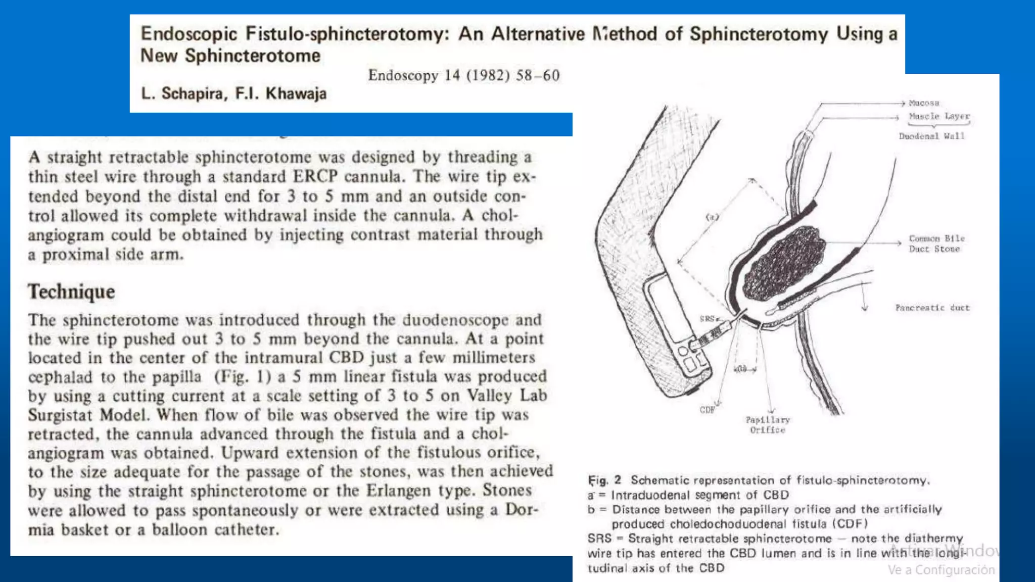 Precut ERCP, Fistulotomy, Papillotomy, Transpancreatic sphincterotomy ...