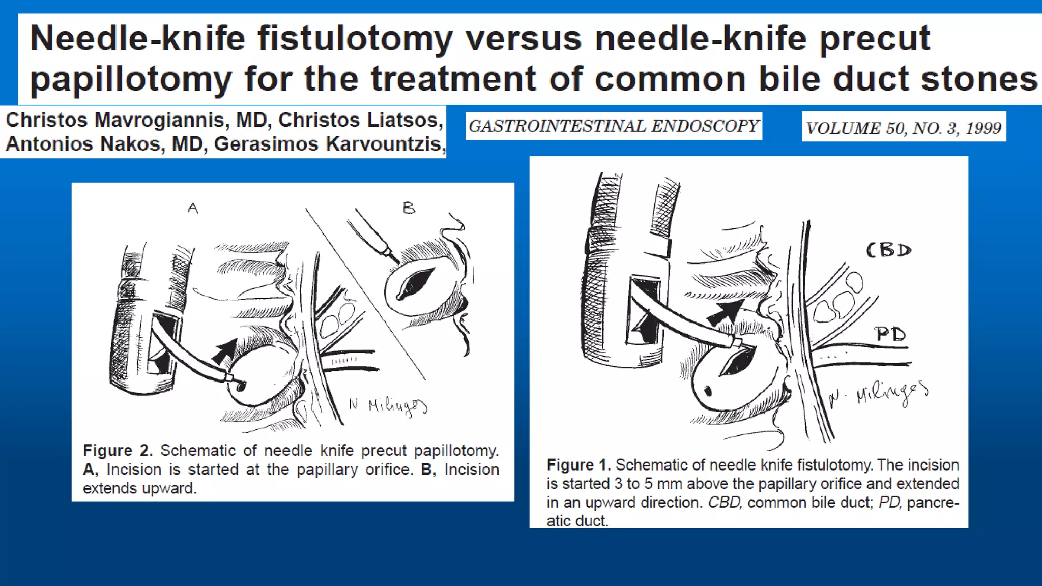Precut ERCP, Fistulotomy, Papillotomy, Transpancreatic sphincterotomy ...