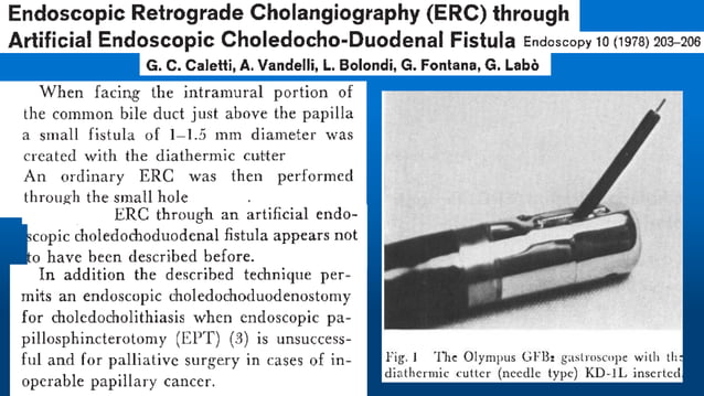 Precut ERCP, Fistulotomy, Papillotomy, Transpancreatic sphincterotomy ...