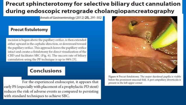 Precut ERCP, Fistulotomy, Papillotomy, Transpancreatic sphincterotomy ...