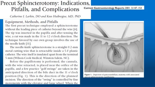 Precut ERCP, Fistulotomy, Papillotomy, Transpancreatic sphincterotomy…