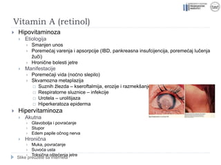 Predavanje - Nutritivne bolesti 2018.pptx