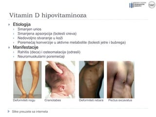 Predavanje - Nutritivne bolesti 2018.pptx