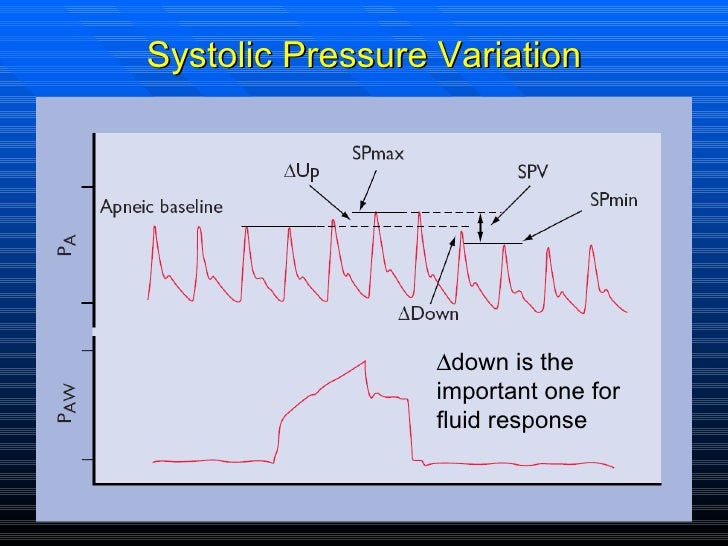 Predicting fluid response in the ICU