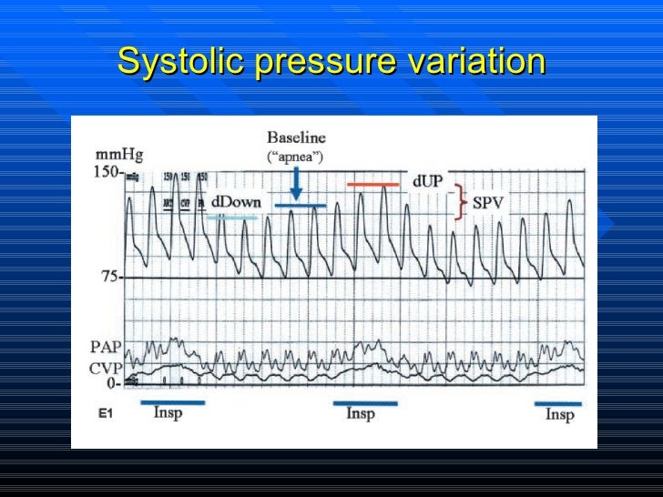Pulse Pressure Variation: Pulse Pressure Variation Formula – NADOX