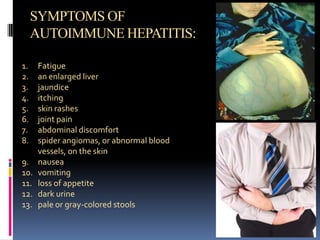 liver mediated diseases and viral hepatitis | PPTX