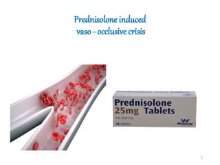 Prednisone induced vaso occlusion | PPT