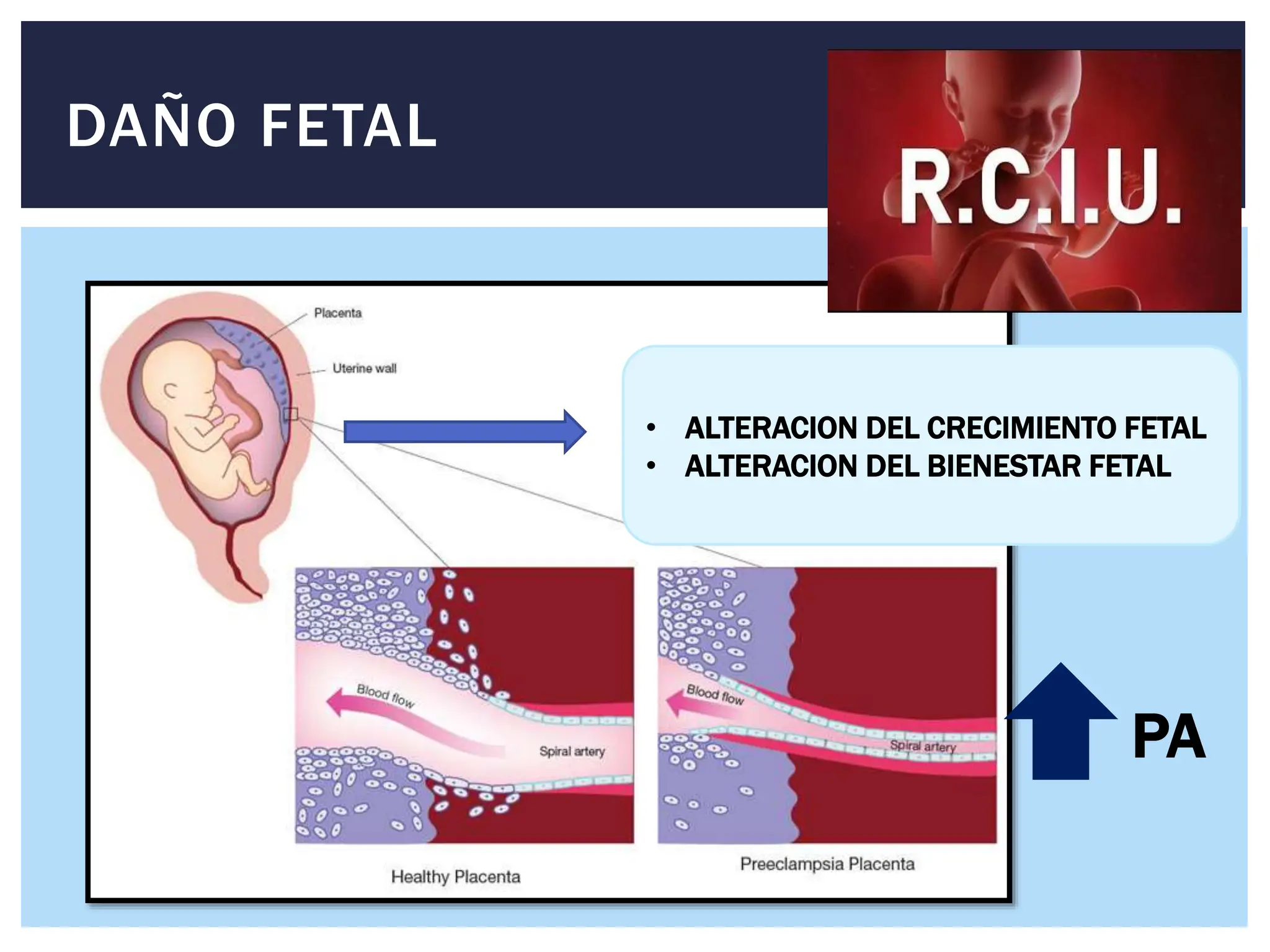 PREECLAMPSIA TERAPEUTICA EN OBSTETRICIA Y GINECOLOGIA | PPTX