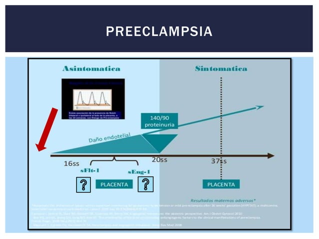 PREECLAMPSIA TERAPEUTICA EN OBSTETRICIA Y GINECOLOGIA | PPT